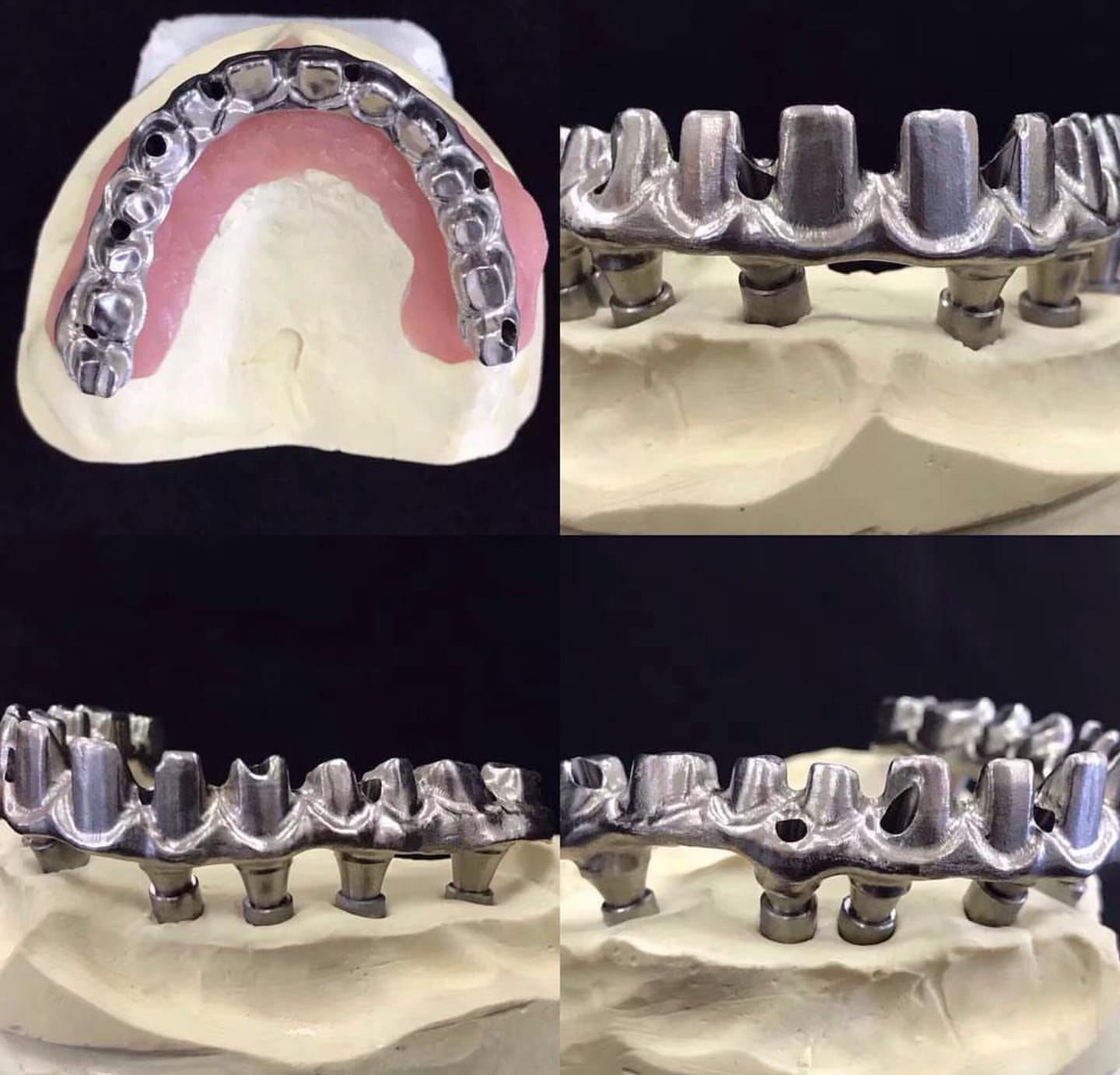 All on 4 & 6 - Solutions sûres et fiables - Usinés titane/zircone